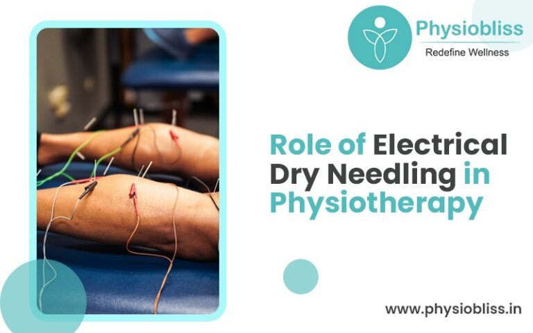 Electric Dry Needling in Physiotherapy- Physiobliss